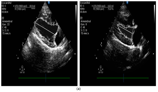 Translational Echocardiography: The Dog as a Clinical Research Model of ...