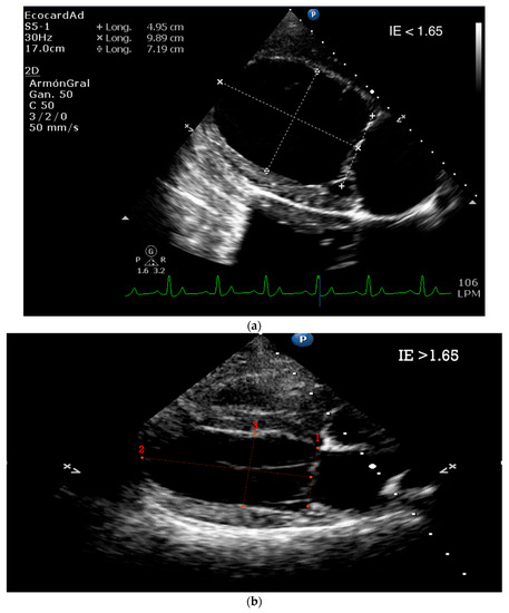 Translational Echocardiography: The Dog as a Clinical Research Model of ...
