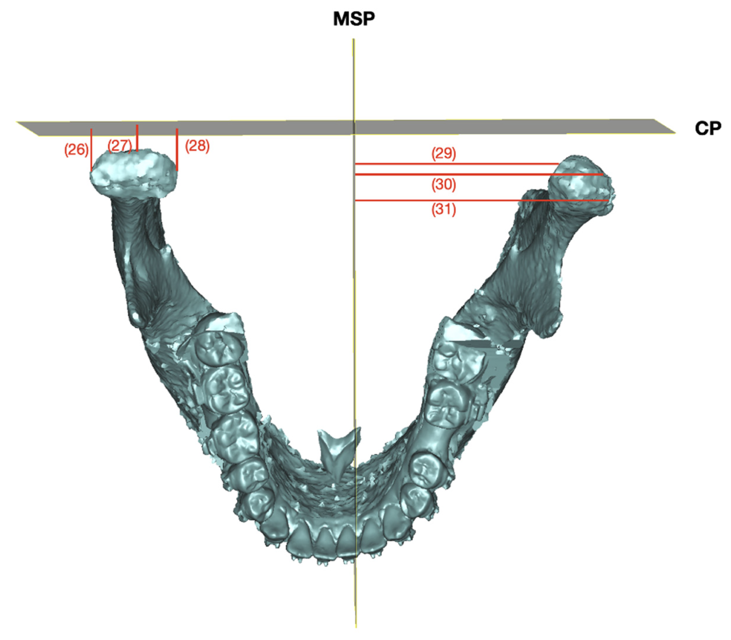 Applied Sciences | Free Full-Text | Preoperative Anatomical Variables Affecting the Outcome of ...