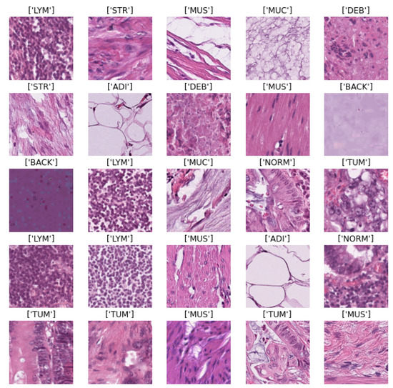 Applied Sciences | Free Full-Text | Computer Aided Classifier of ...