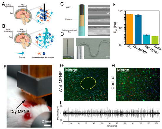 Material Design in Implantable Biosensors toward Future Personalized ...