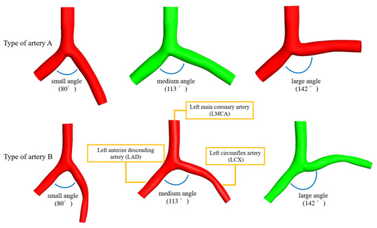 Restenosis Investigation of Two-Stent Placement in the Artery Bifurcation with Different ...