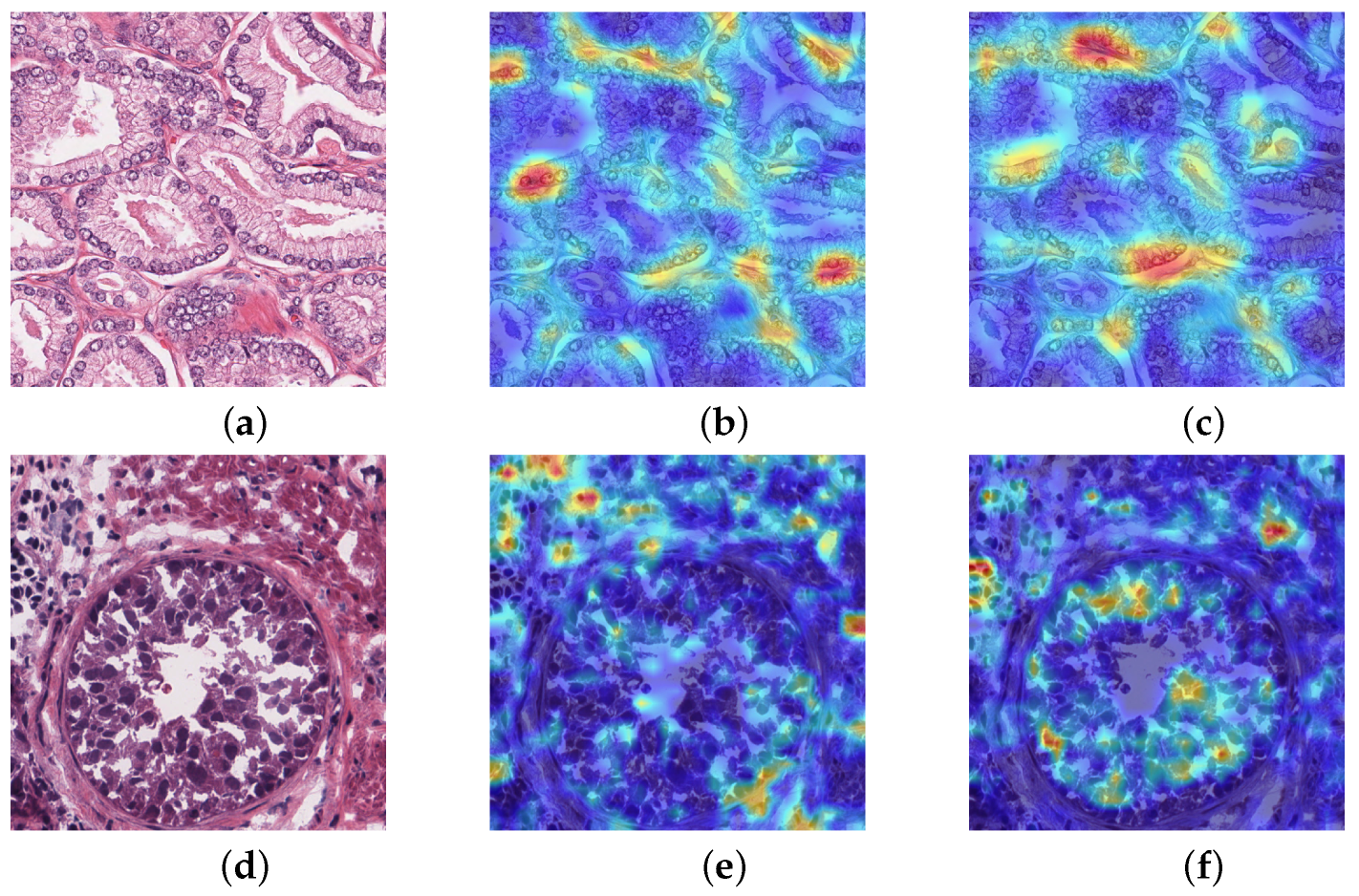 MIU-Net: MIX-Attention and Inception U-Net for Histopathology Image ...