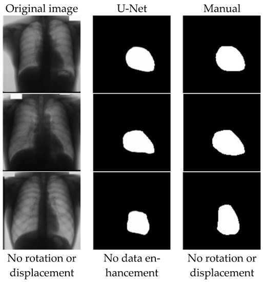 Applied Sciences | Free Full-Text | A Segmentation Method Based on PDNet for Chest X-rays with ...