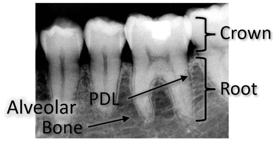 An Efficient Spring Model for an Integrated Orthodontic Tooth Movement ...