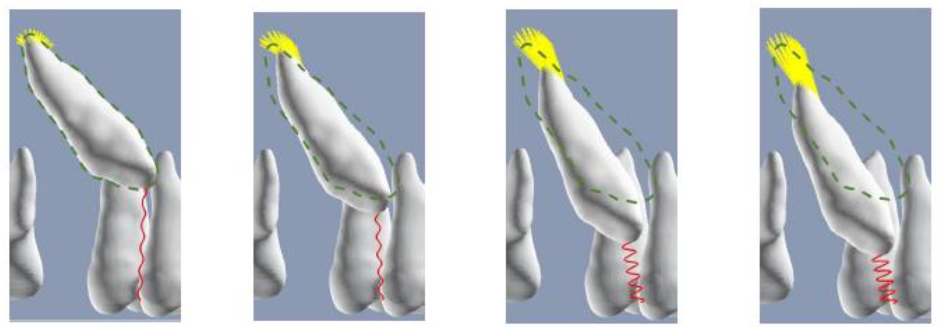 An Efficient Spring Model for an Integrated Orthodontic Tooth Movement ...