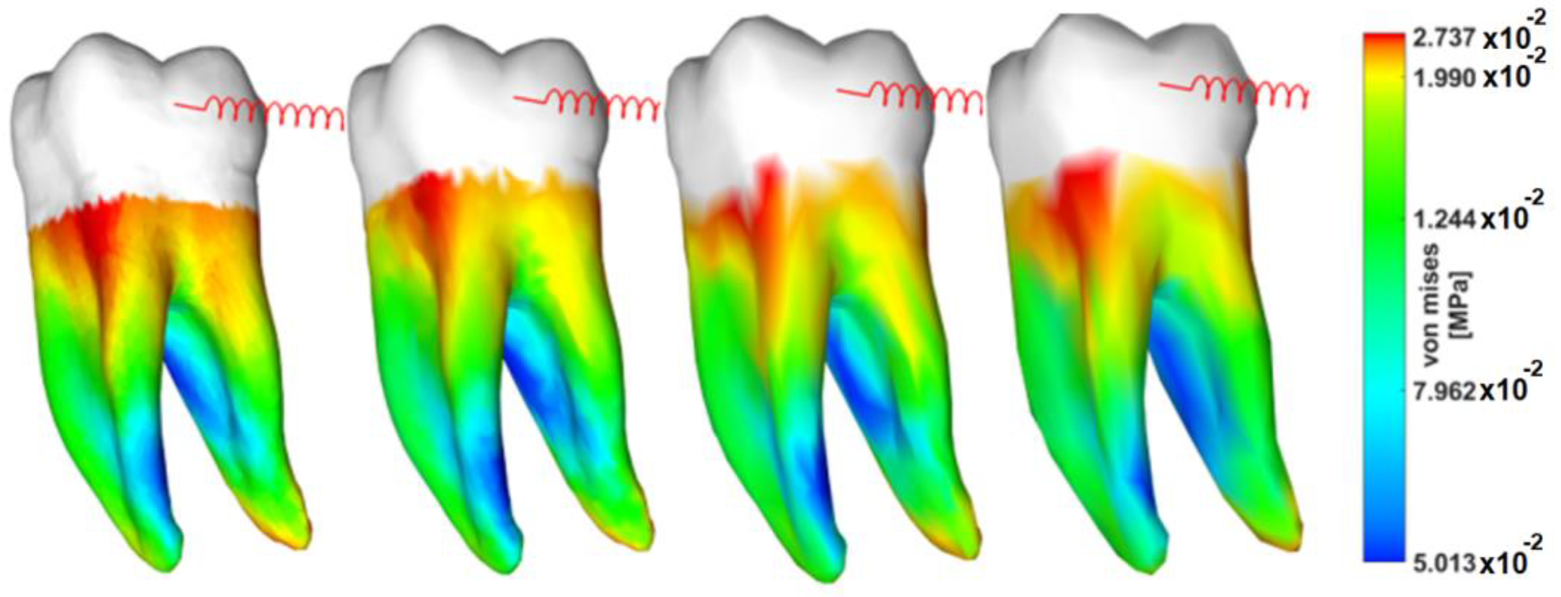 An Efficient Spring Model for an Integrated Orthodontic Tooth Movement ...