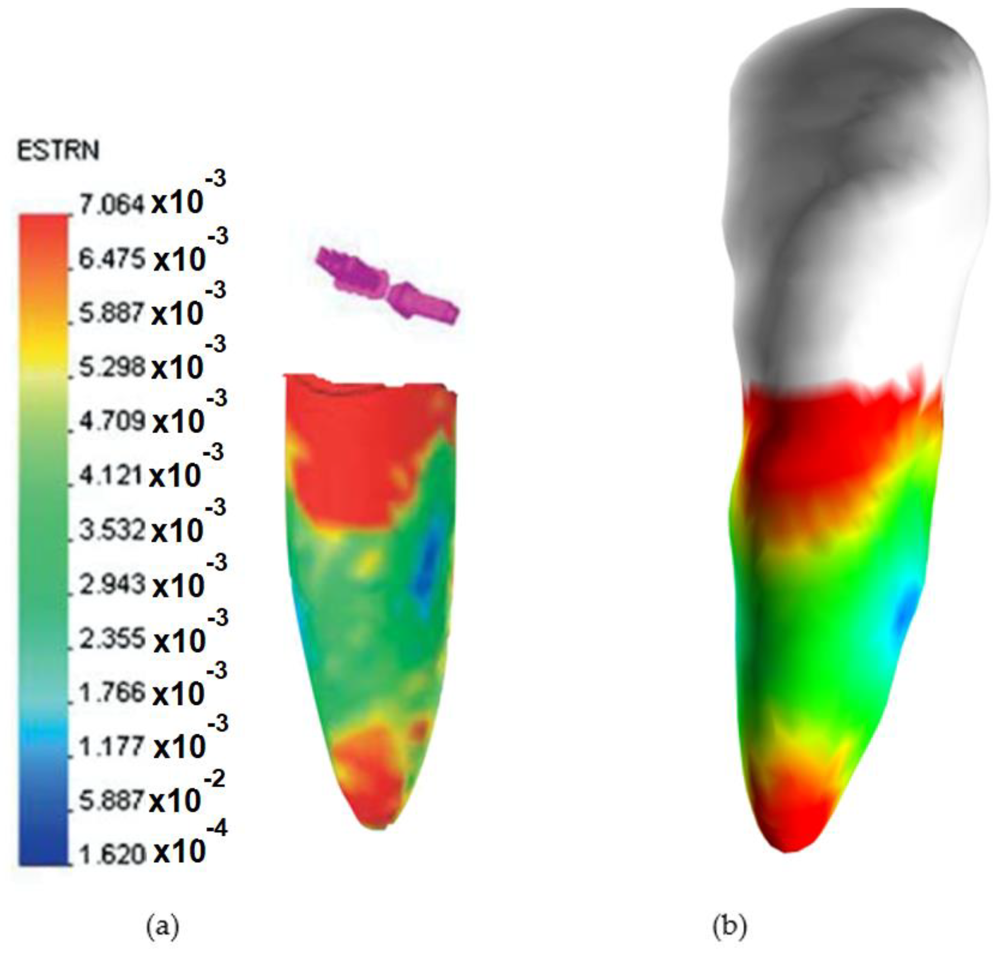 An Efficient Spring Model for an Integrated Orthodontic Tooth Movement ...