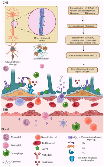 Neuromyelitis Optica Spectrum Disorders: Clinical Perspectives ...
