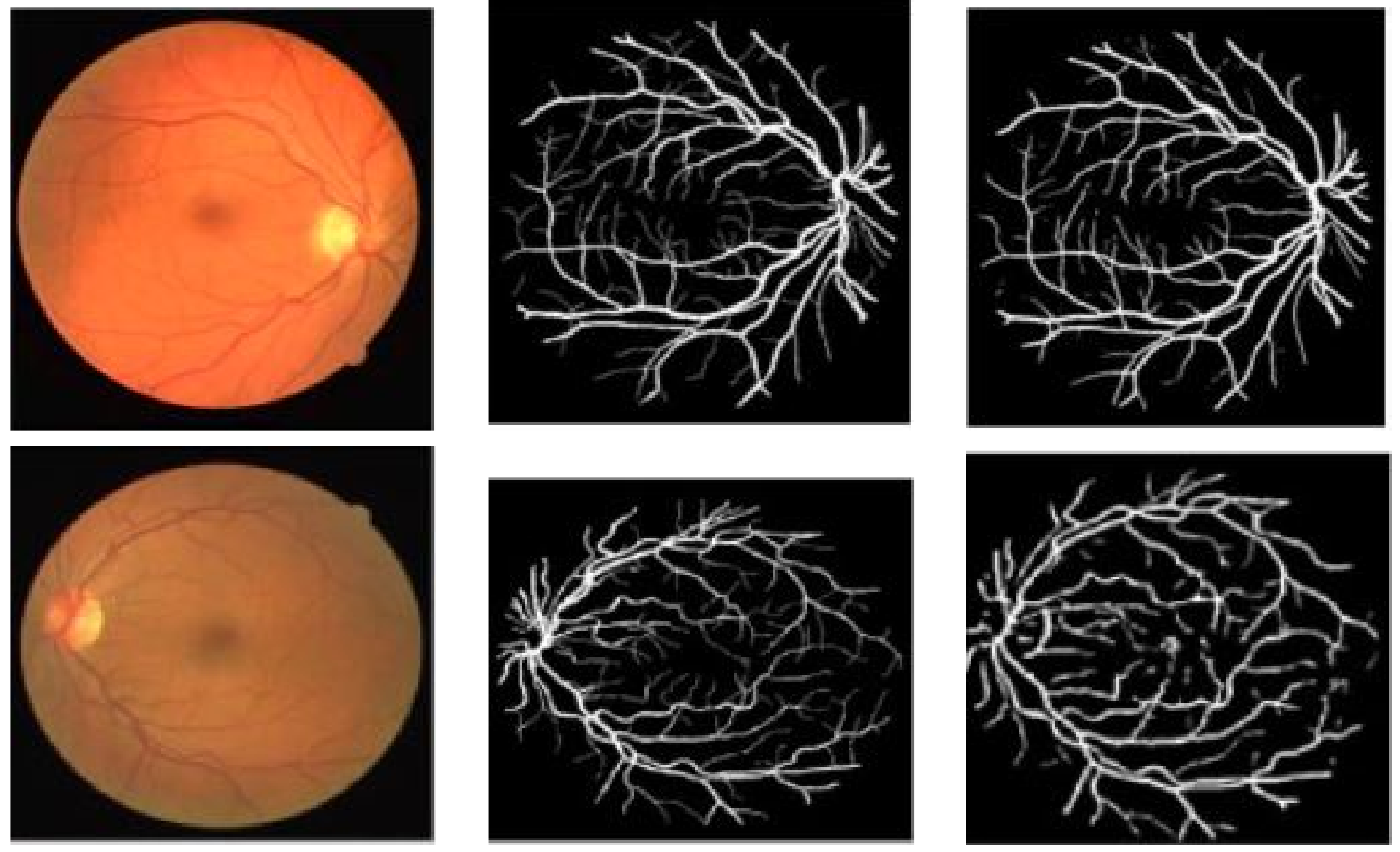 Applied Sciences | Free Full-Text | A Survey on Diabetic Retinopathy ...