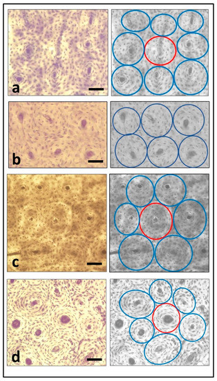 The Arrangement of the Osteons and Kepler’s Conjecture
