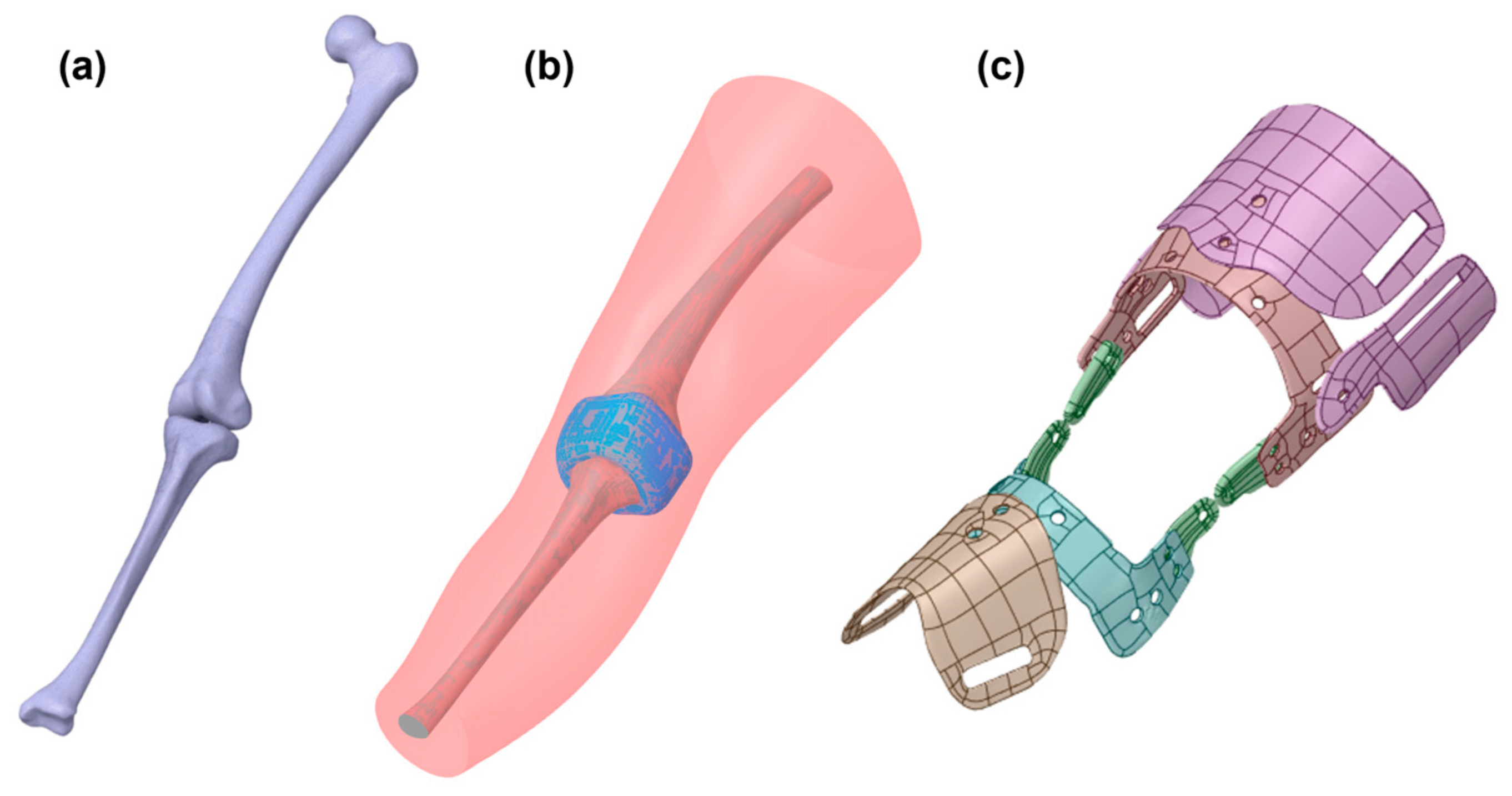 Analysis of a Motocross Knee Brace: From the Real Model to the ...