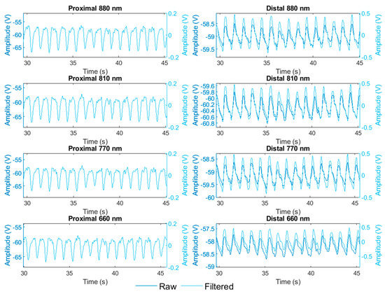 A Non-Invasive Optical Multimodal Photoplethysmography-Near Infrared ...