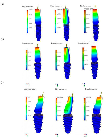 Finite Element Analysis (FEA) for a Different Type of Cono-in Dental ...