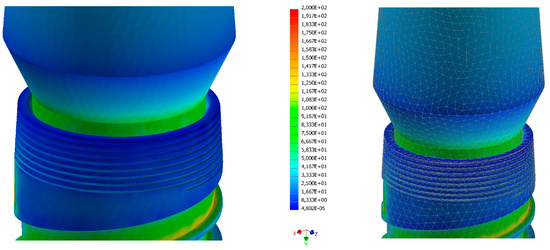 Finite Element Analysis (FEA) for a Different Type of Cono-in Dental ...
