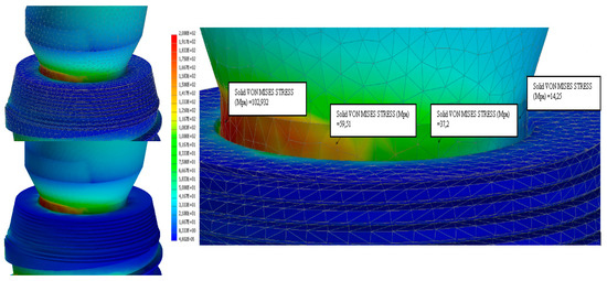 Finite Element Analysis (FEA) for a Different Type of Cono-in Dental ...