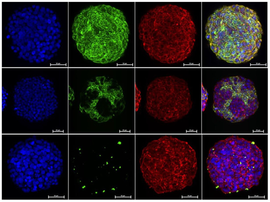 Colorectal Cancer Cell Spheroids Co-Cultured with Molecularly Imprinted ...