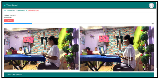 Modelling Proper and Improper Sitting Posture of Computer Users Using Machine Vision for a Human ...
