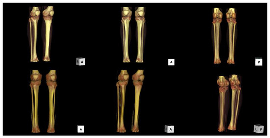 Quadriceps Muscle and Medial Retinaculum Combinate Effects on Patellar ...