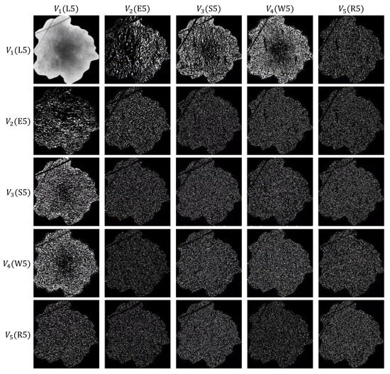 Skin Lesion Classification Using Hybrid Convolutional Neural Network with Edge, Color, and ...