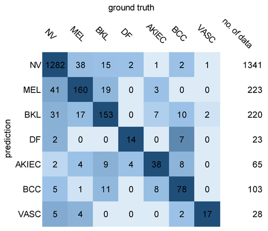 Skin Lesion Classification Using Hybrid Convolutional Neural Network with Edge, Color, and ...