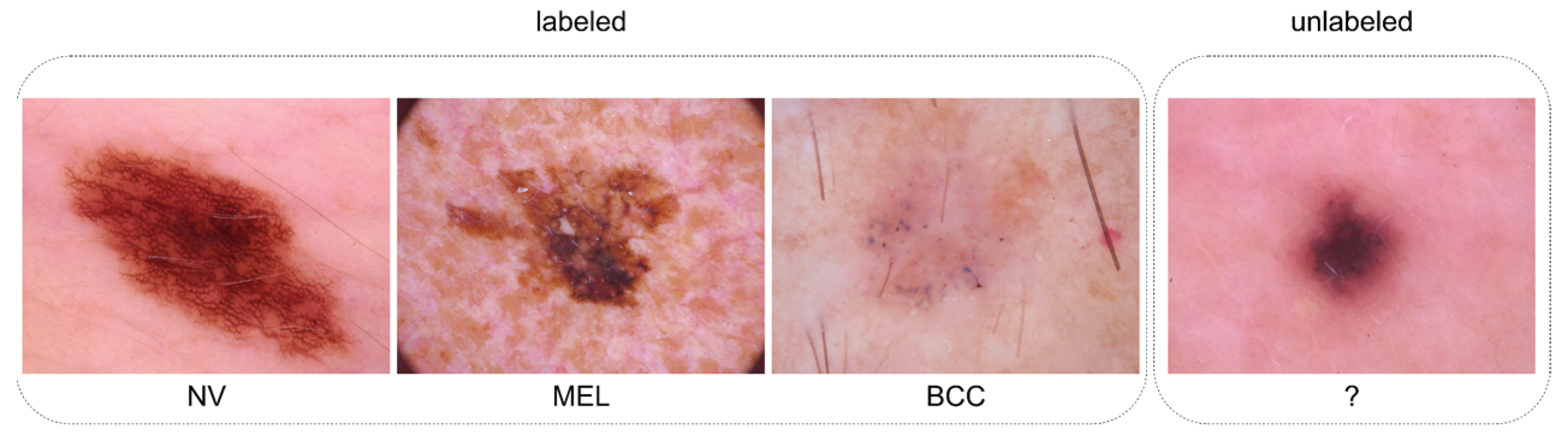 Applied Sciences | Free Full-Text | Semi-Supervised Medical Image ...