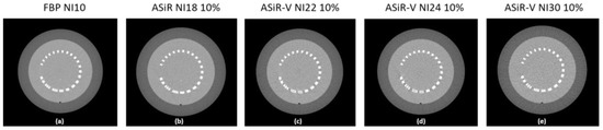 New-Generation ASiR-V for Dose Reduction While Maintaining Image ...