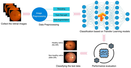 Applied Sciences | Free Full-Text | Transfer Learning for Diabetic Retinopathy Detection: A ...
