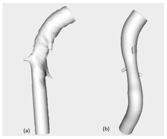 Computational Fluid Dynamics (CFD) and Finite Element Analysis (FEM) of ...