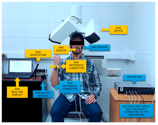 Synchronization of Surface Electromyography and 3D Electromagnetic ...