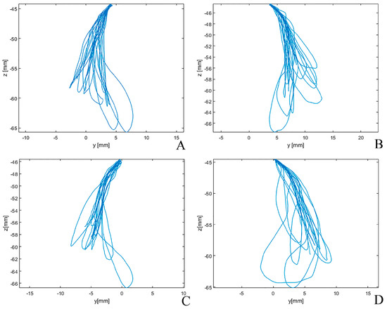 Synchronization of Surface Electromyography and 3D Electromagnetic ...
