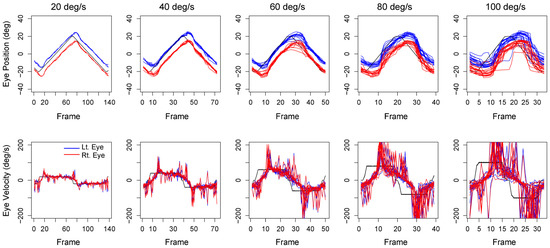Development of a New Eye Movement Measurement Device Using Eye-Tracking ...