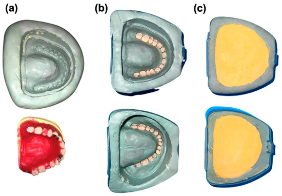 Vertical Occlusal Dimension Changes of Complete Dentures between ...