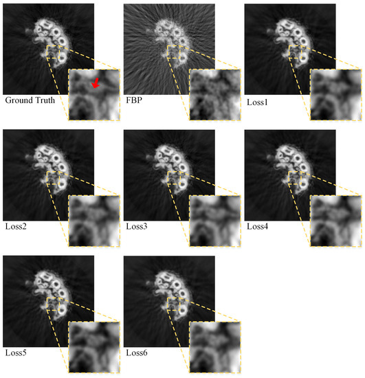 Learning from Projection to Reconstruction: A Deep Learning ...