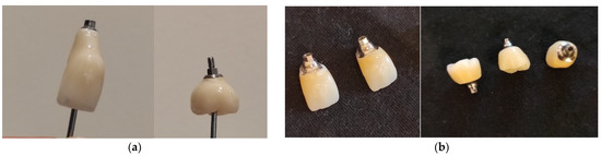 Mechanical Resistance of Different Implant Suprastructures: A ...