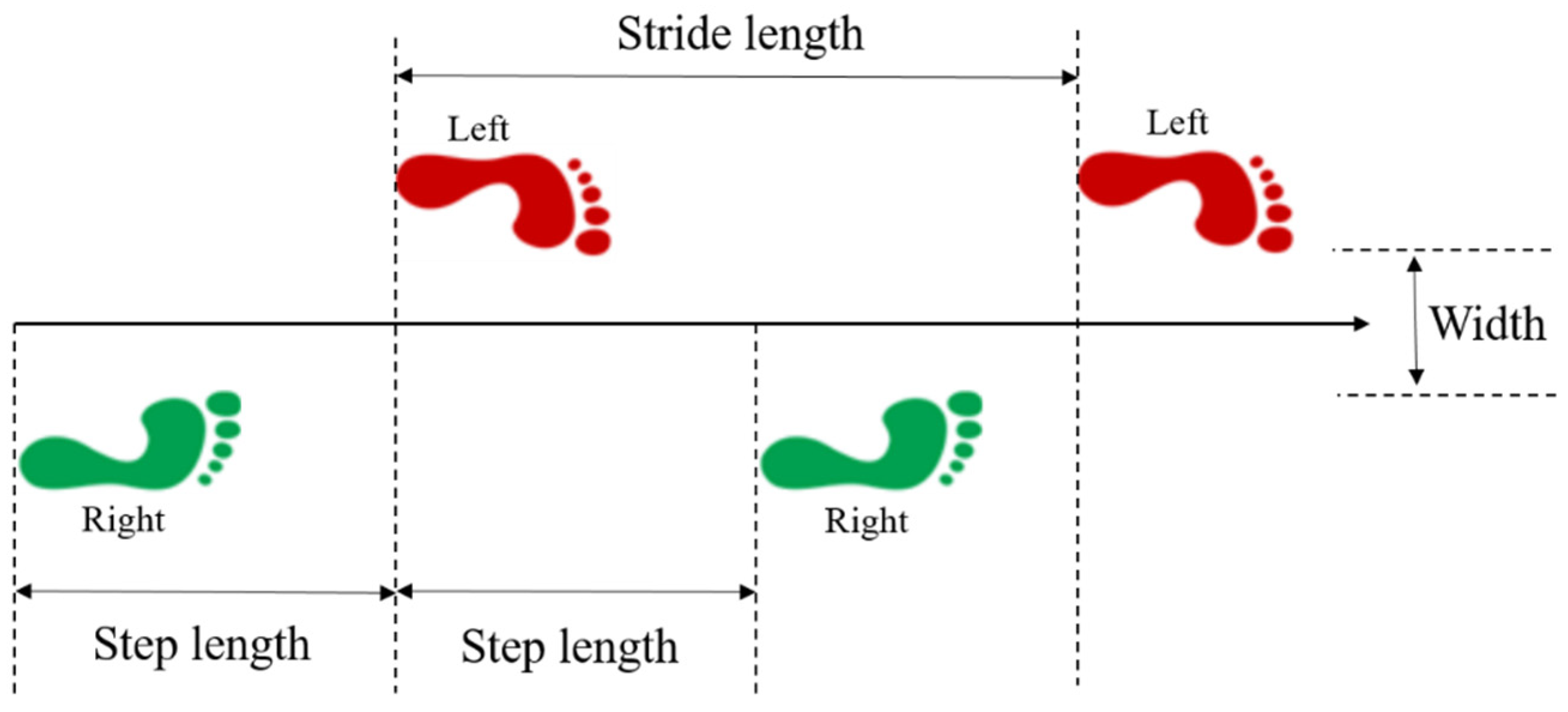 Changes of Gait Patterns after Correction of Refractive Error in the ...