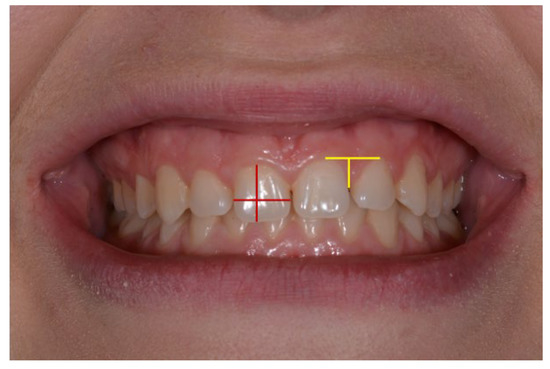 Traditional, 2D and 3D Workflows: What Is Better for Aesthetic ...