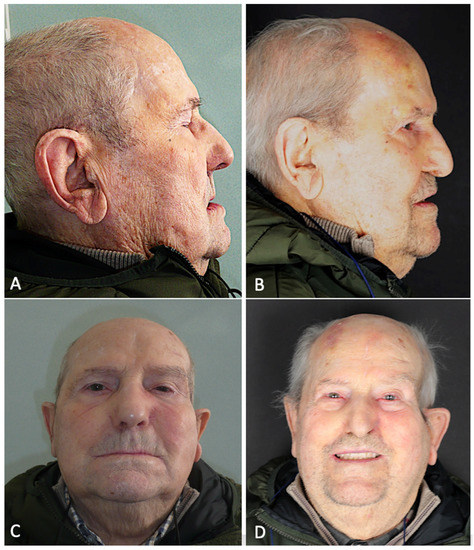 Applied Sciences | Free Full-Text | Primary Reconstruction of Total ...