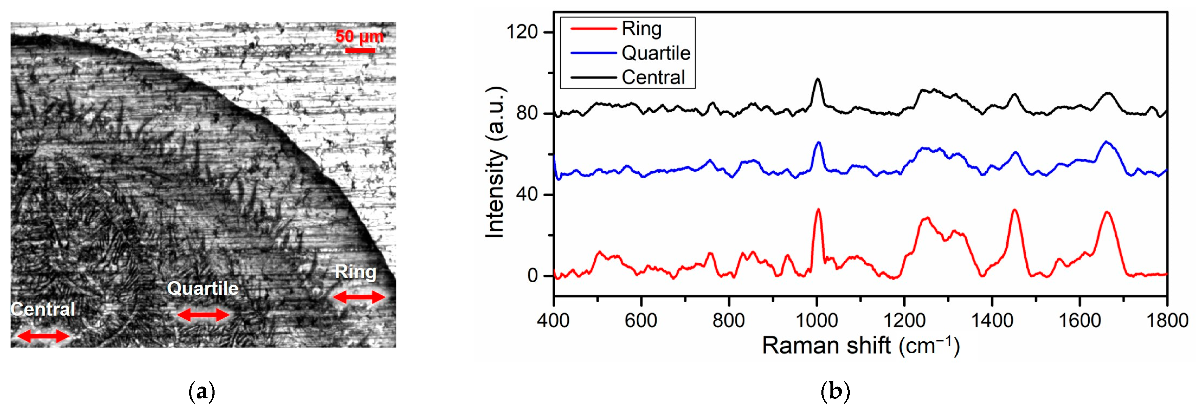 Label-Free Detection and Classification of Glaucoma Based on Drop ...