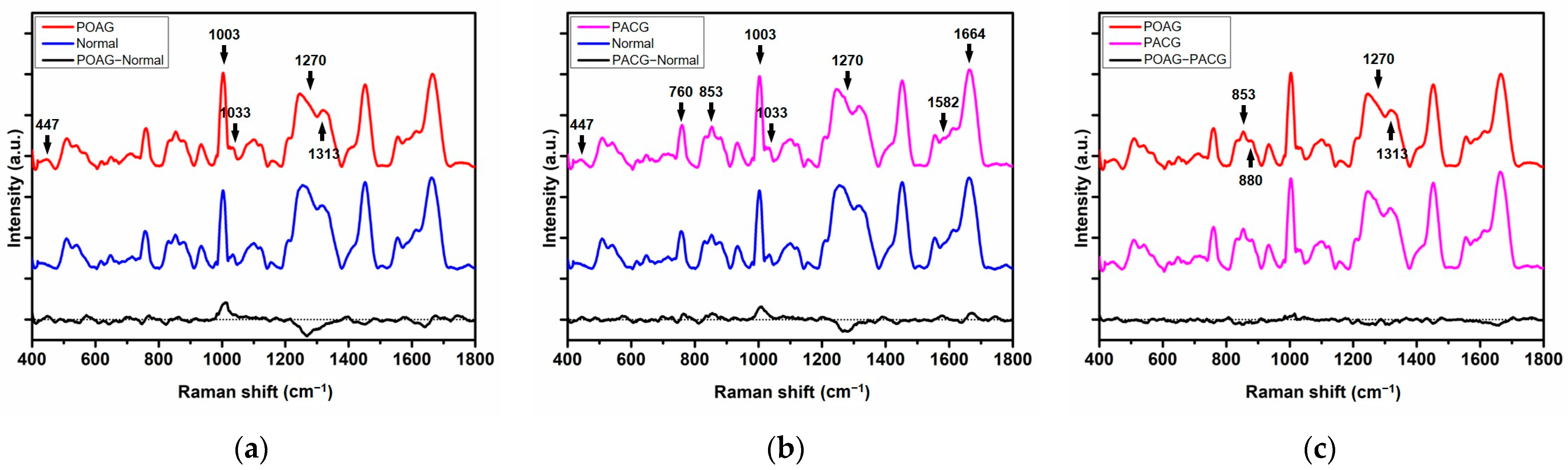 Label-Free Detection and Classification of Glaucoma Based on Drop ...