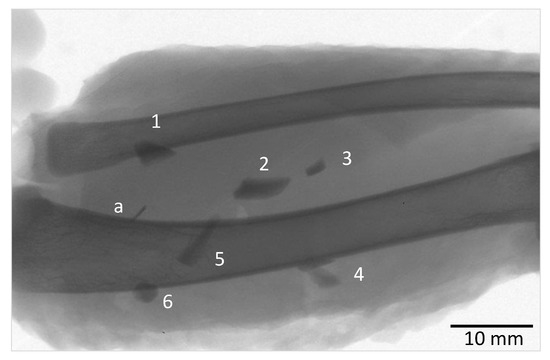 Comparing the Accuracy of Micro-Focus X-ray Technology to Standard ...
