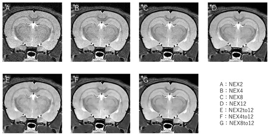 Development and Evaluation of Deep Learning-Based Reconstruction Using ...