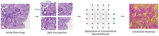A Novel Convolutional Neural Network Algorithm for Histopathological ...