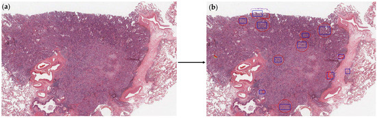 A Novel Convolutional Neural Network Algorithm for Histopathological ...