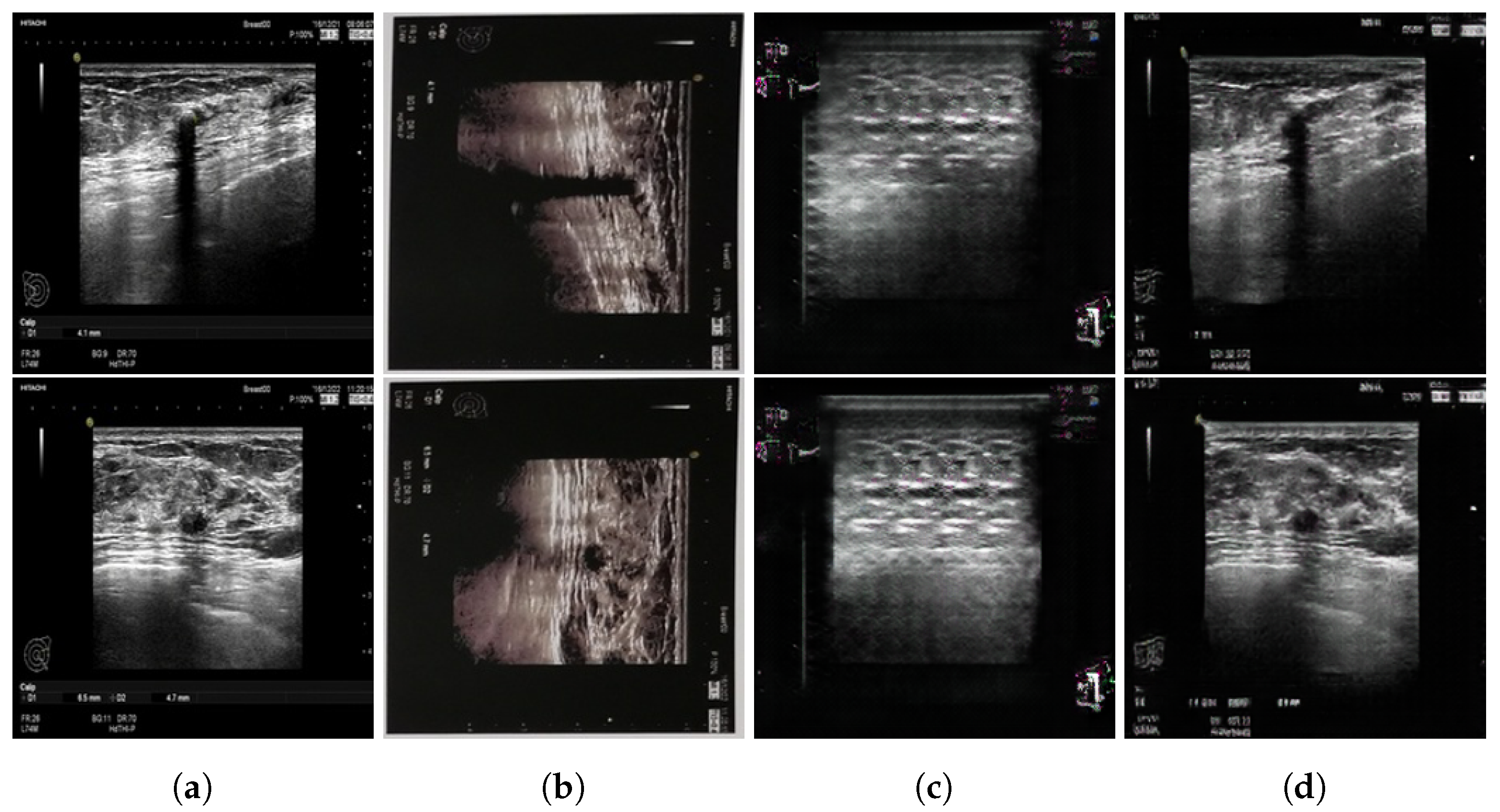 Computer-Aided Diagnosis System for Breast Ultrasound Reports ...