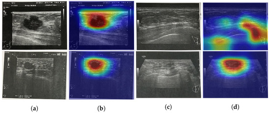 Computer-Aided Diagnosis System for Breast Ultrasound Reports Generation and Classification ...
