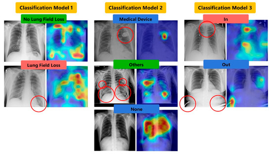 Development of Chest X-ray Image Evaluation Software Using the Deep ...