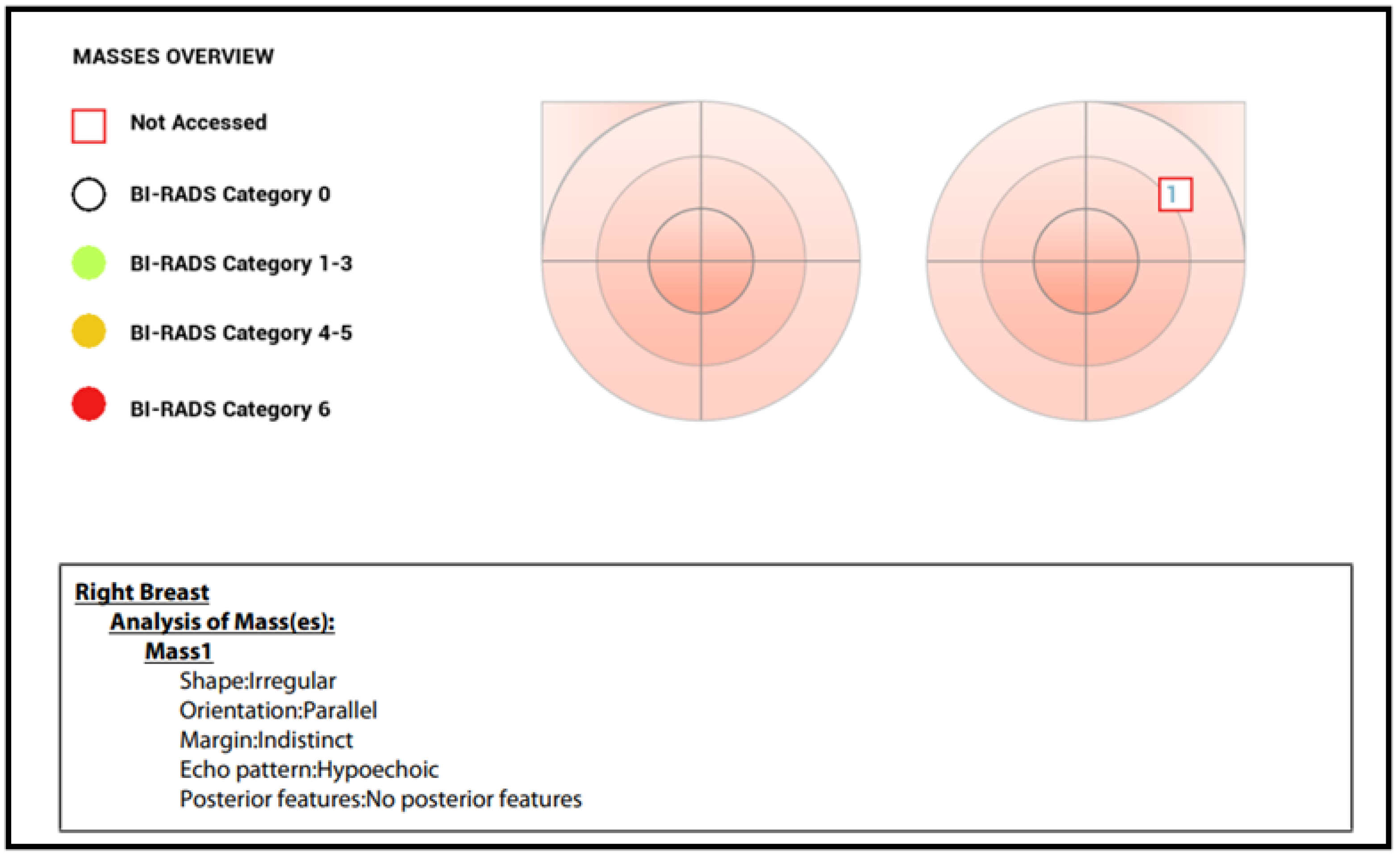 Can New Ultrasound Imaging Techniques Improve Breast Lesion Characterization? Prospective ...
