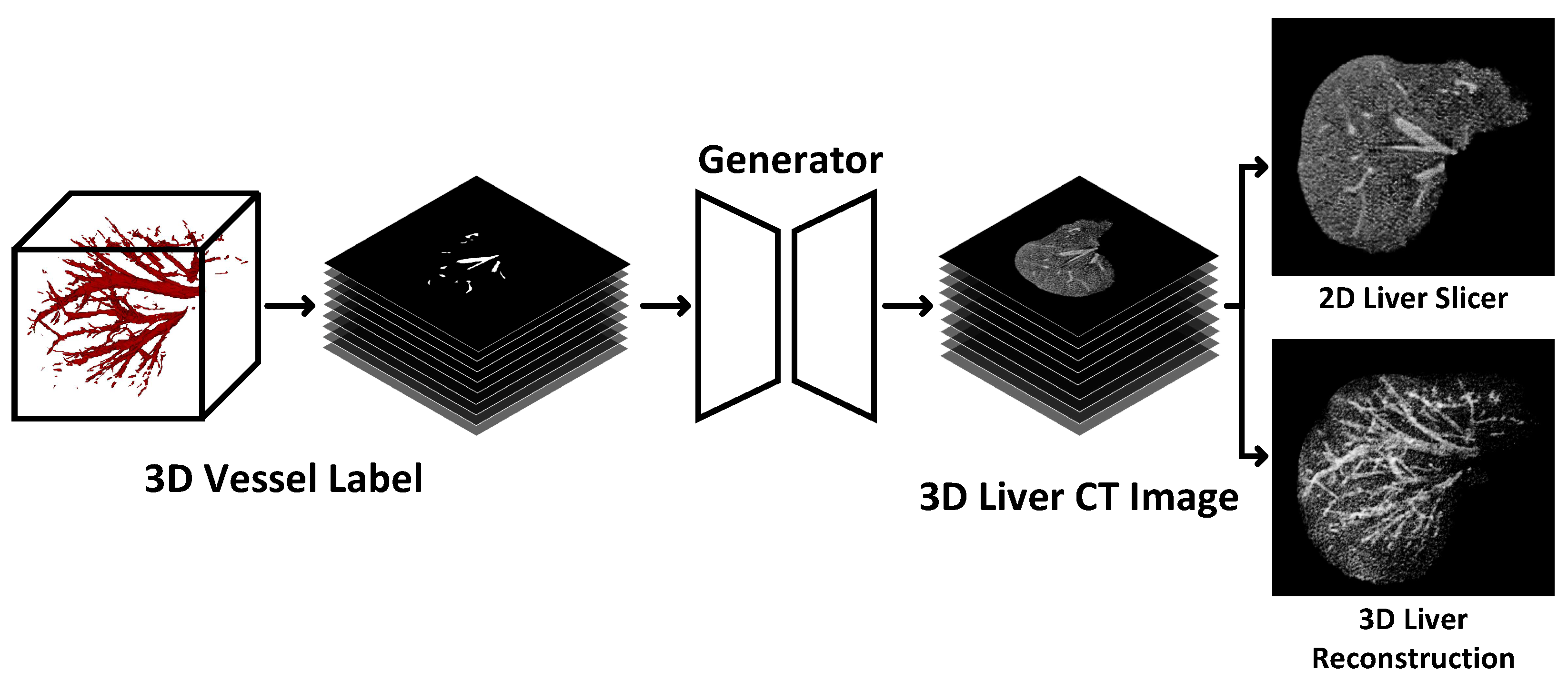 End-to-End 3D Liver CT Image Synthesis from Vasculature Using a Multi-Task Conditional ...