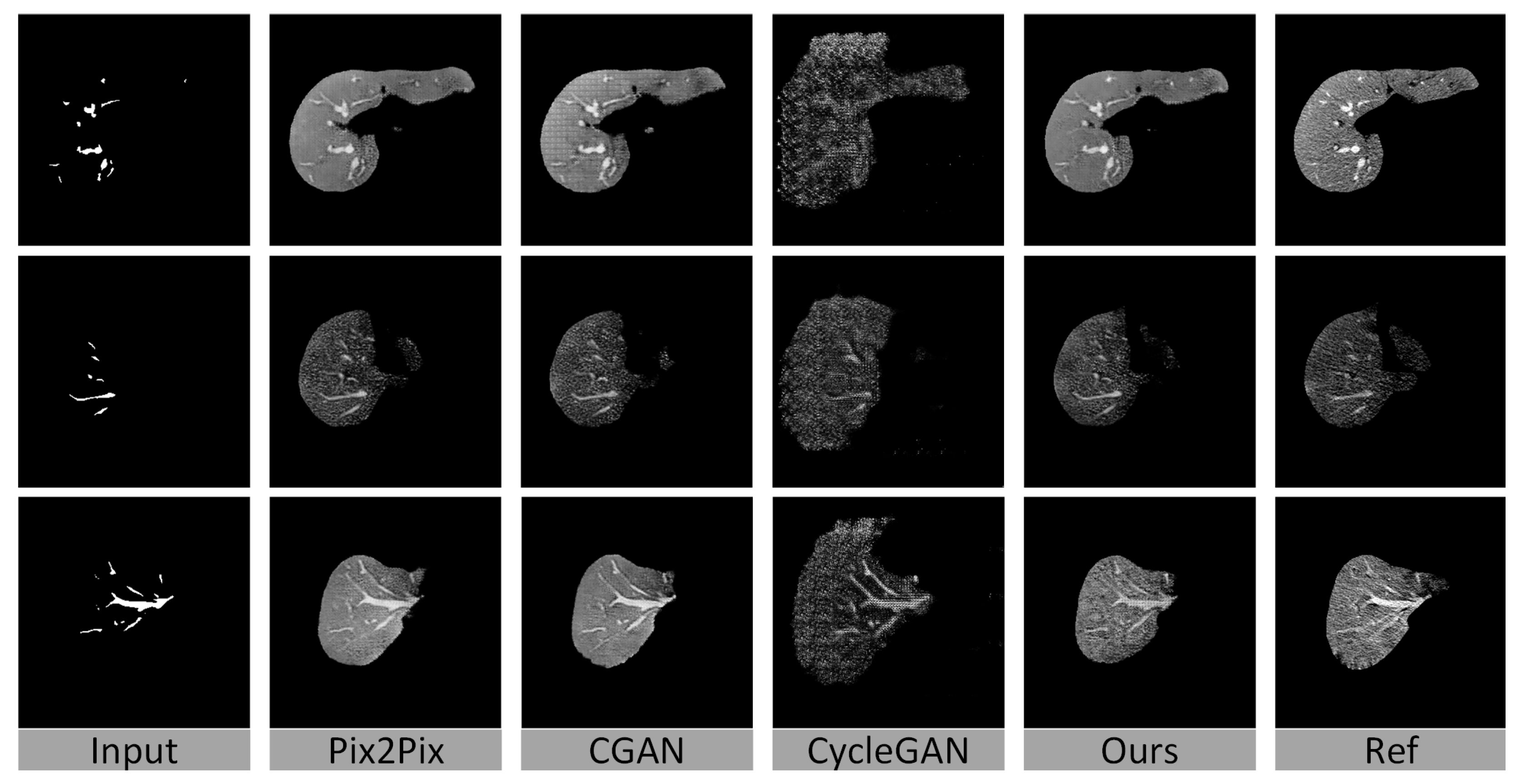 End-to-End 3D Liver CT Image Synthesis from Vasculature Using a Multi-Task Conditional ...